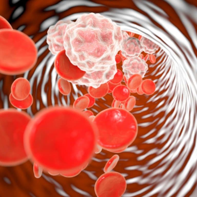 Inflammation - Your body's fire alarm! - Tim Wood Healthcare